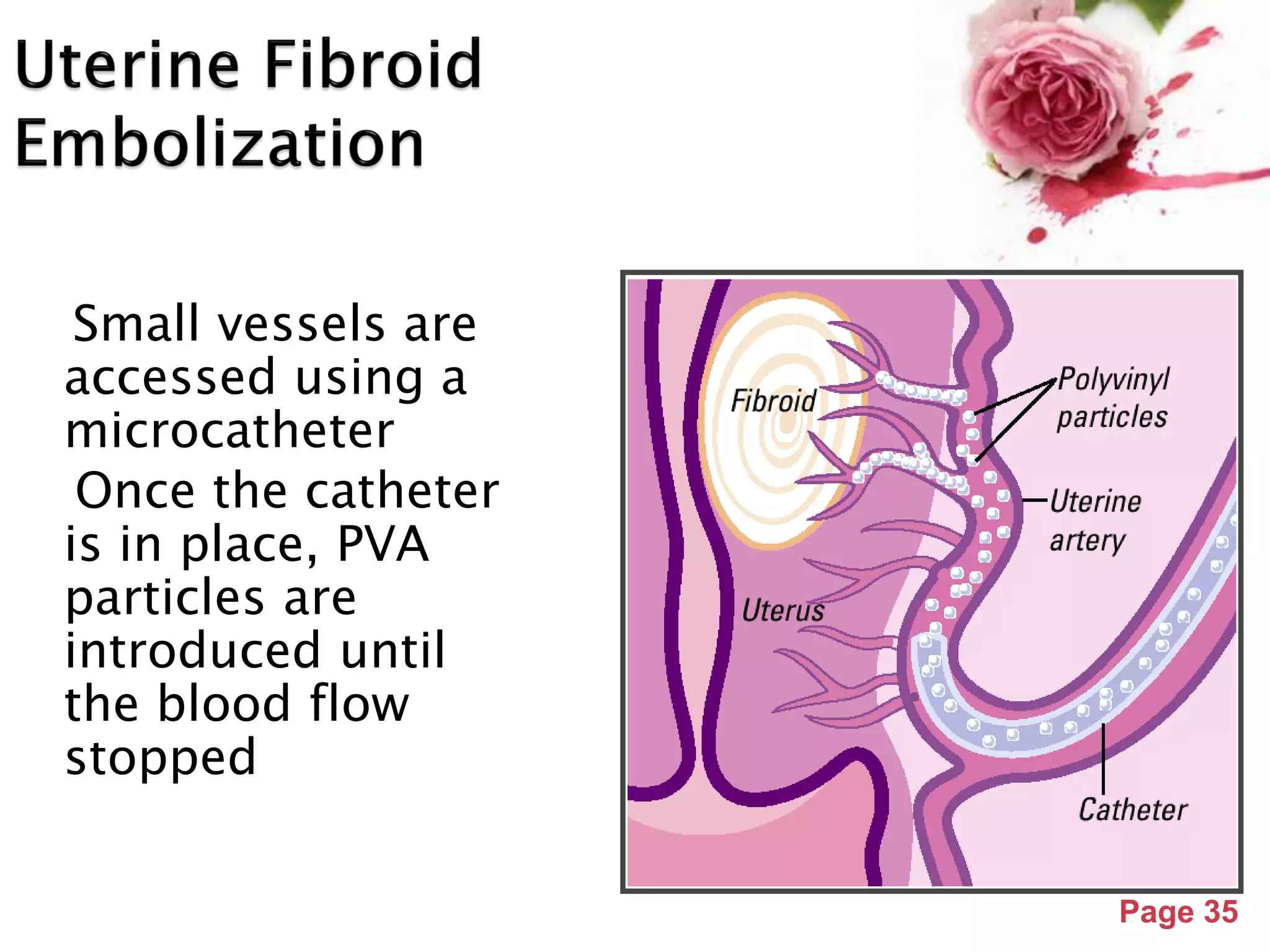 Abnormal uterine bleeding prof jamiyah hassan | PDF