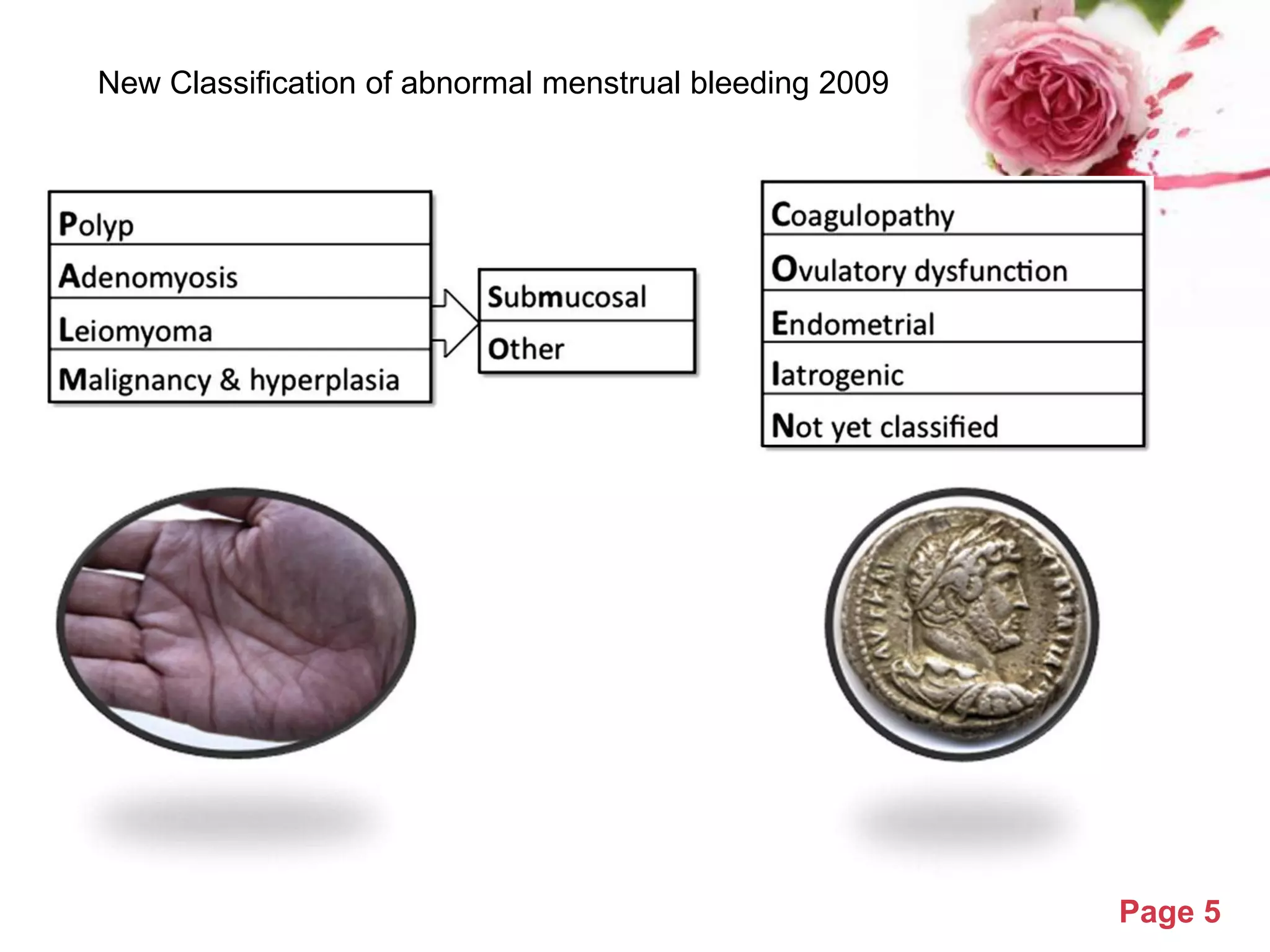 Abnormal uterine bleeding prof jamiyah hassan | PDF