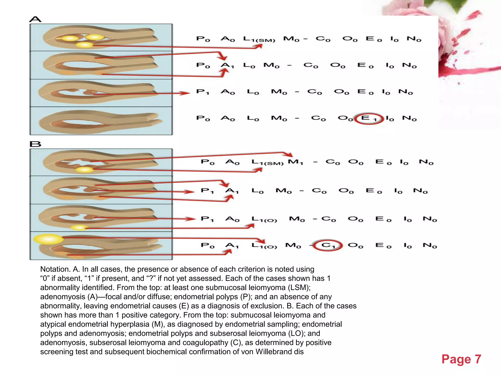 Abnormal uterine bleeding prof jamiyah hassan | PDF