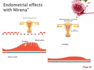 Abnormal uterine bleeding prof jamiyah hassan | PDF