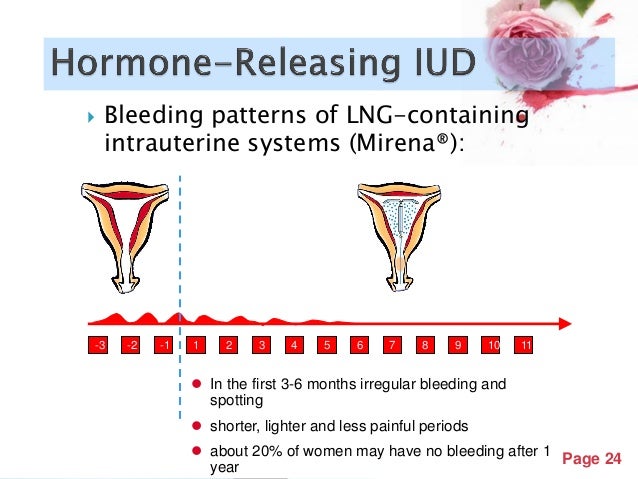 Irregular Bleeding With Mirena