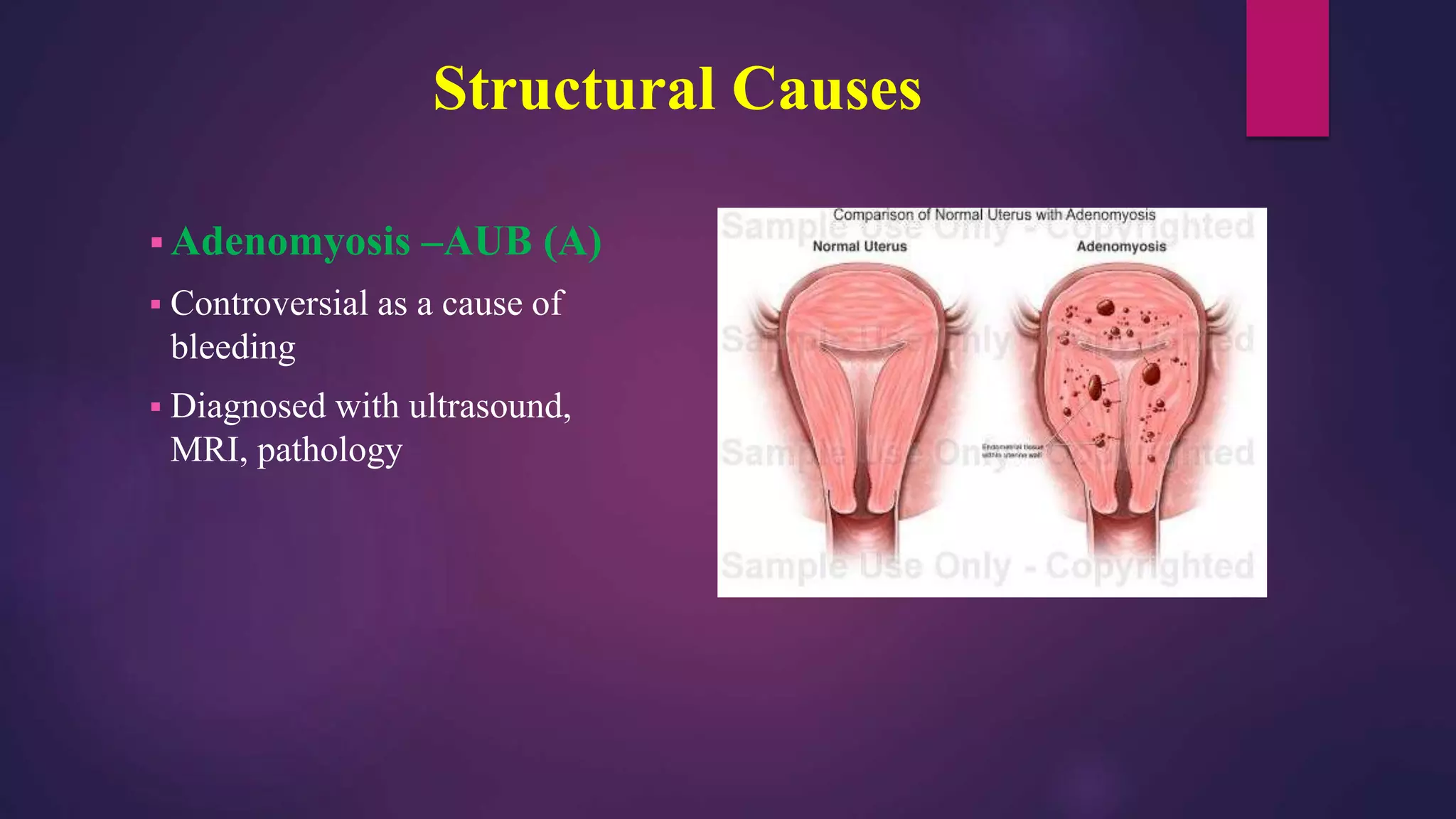 Abnormal uterine bleeding (aub) | PPT