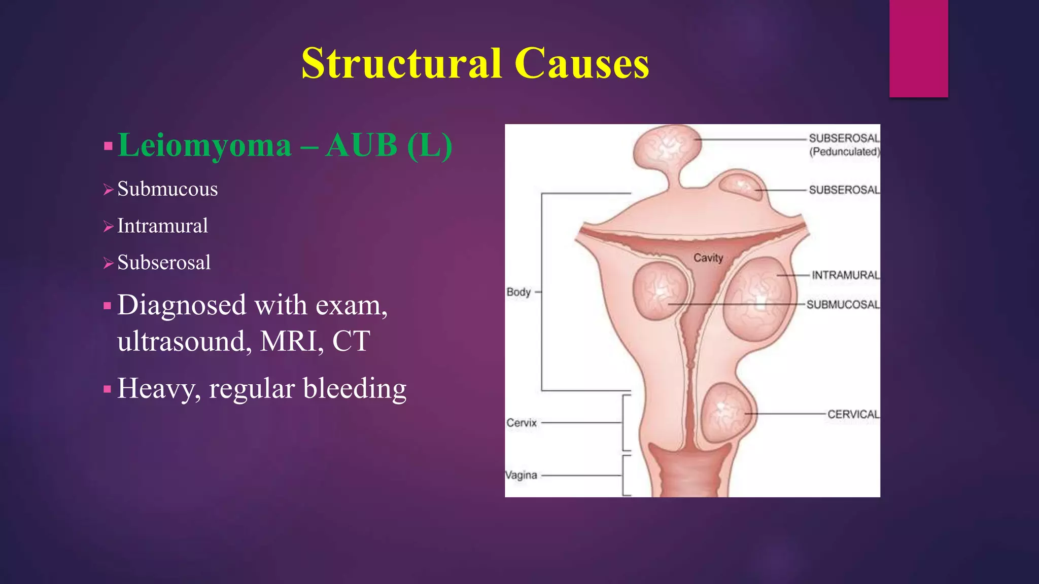 Abnormal uterine bleeding (aub) | PPT
