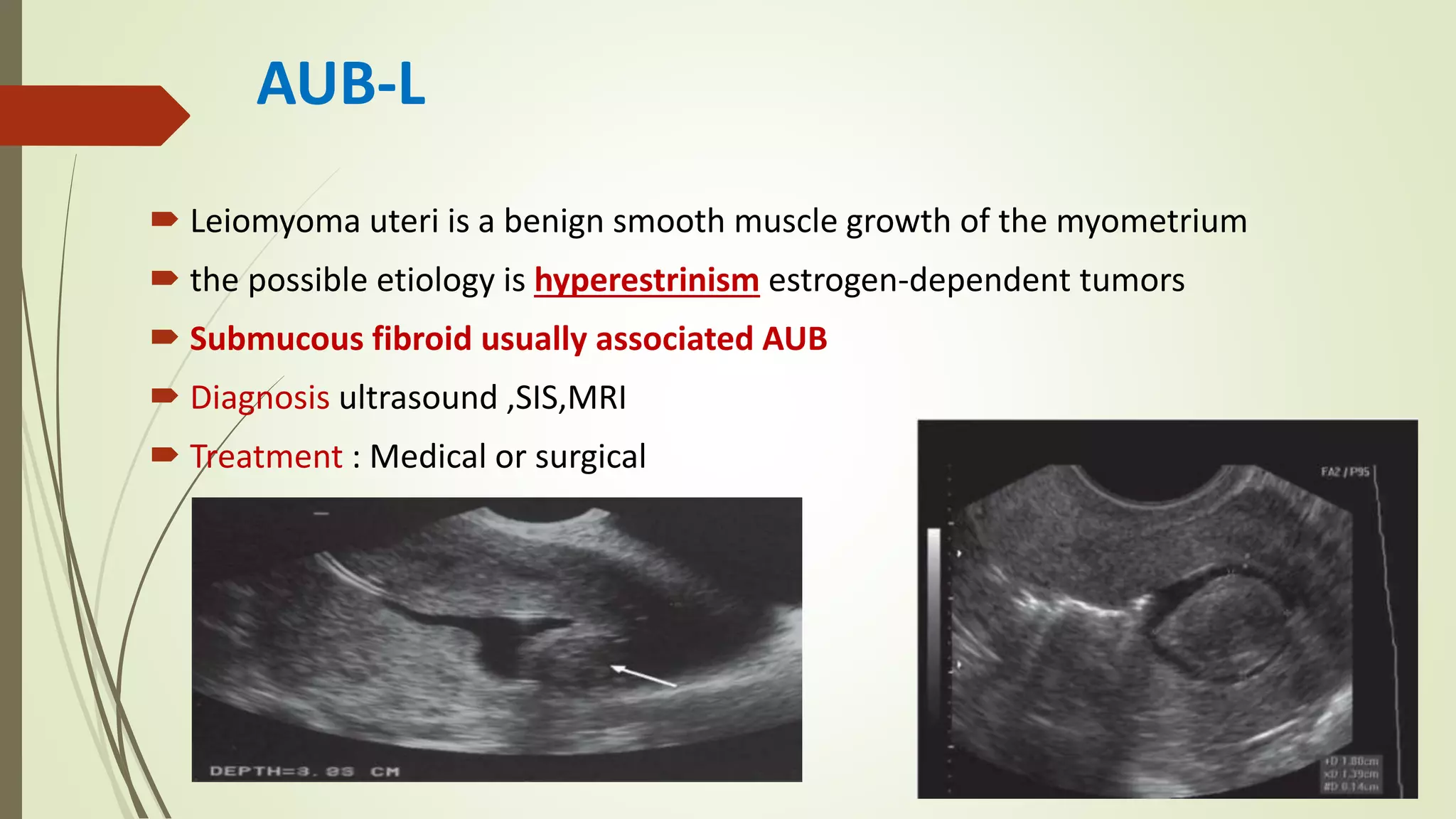 Abnormal Uterine Bleeding (AUB).pptx
