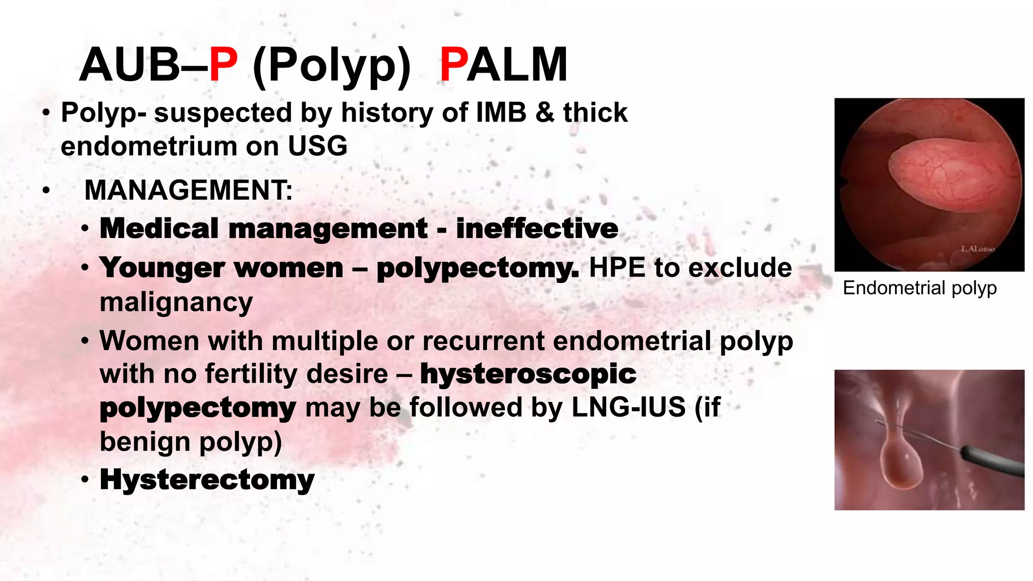 Abnormal uterine bleeding linkind.pptx