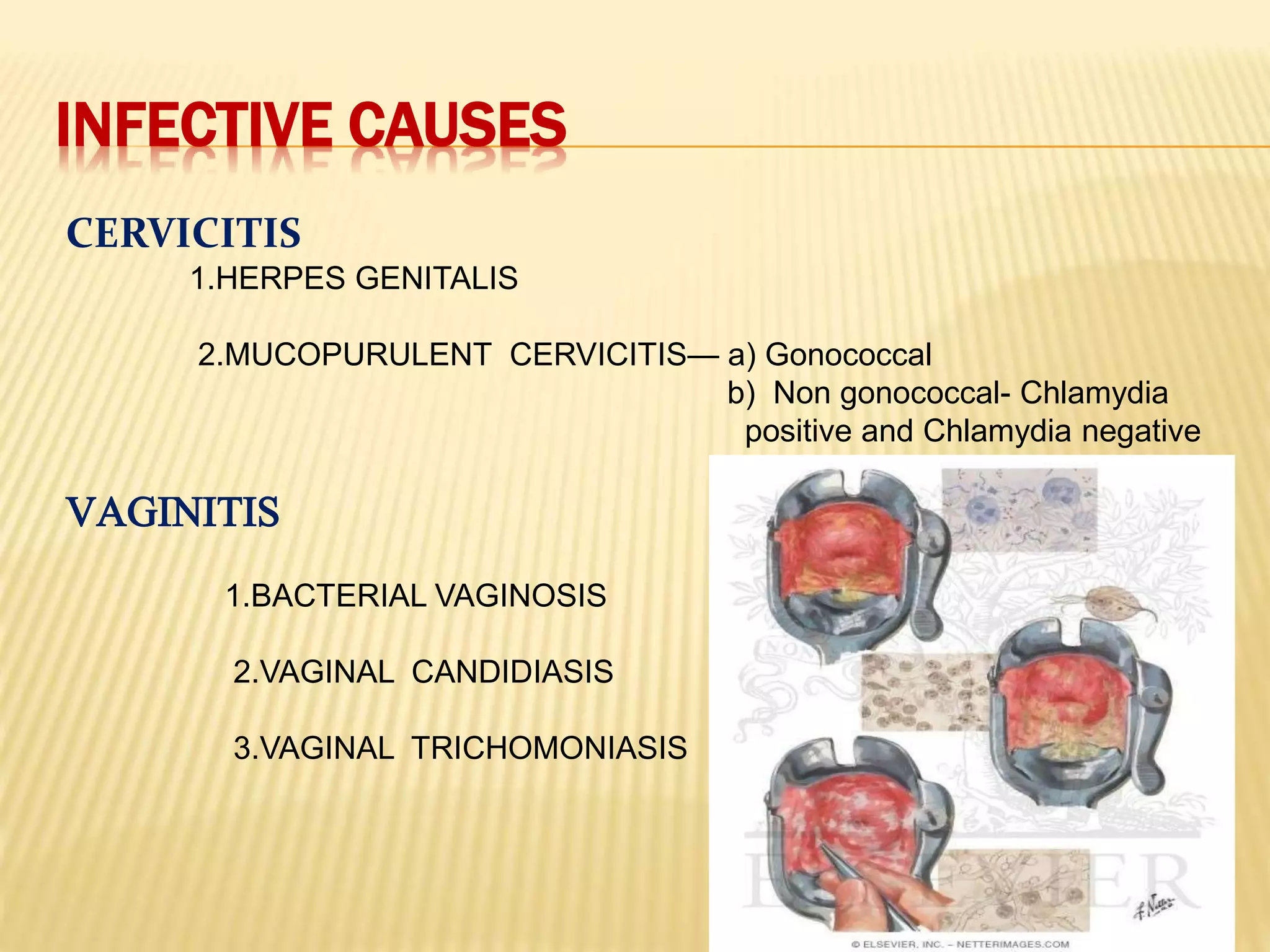 Abnormal vaginal discharge etiopathogenesis | PPTX