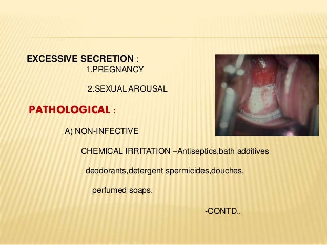 Abnormal vaginal discharge etiopathogenesis