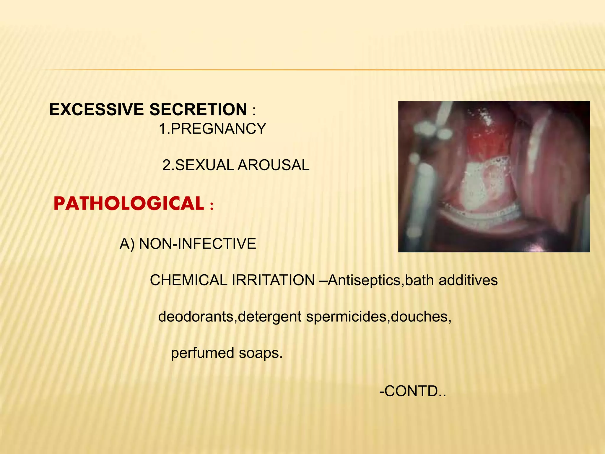 Abnormal vaginal discharge etiopathogenesis-physiological | PPTX