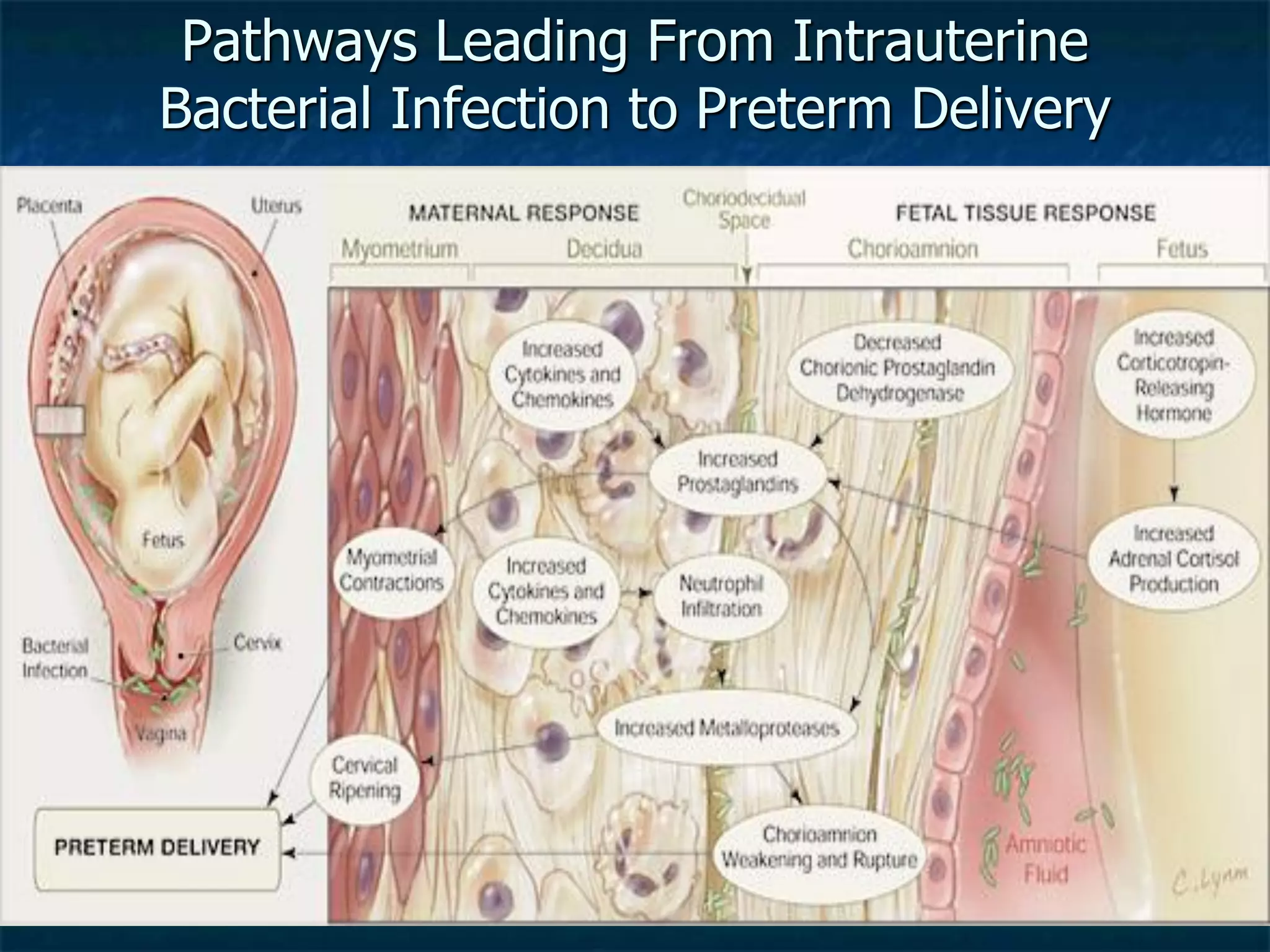 Abnormalities of labour and delivery | PDF