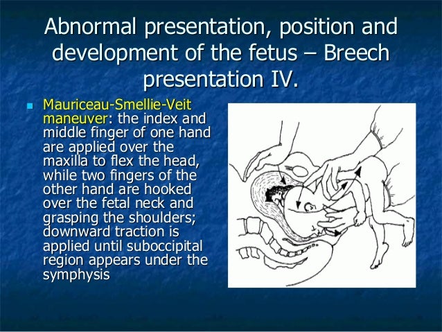 Abnormalities of labour and delivery