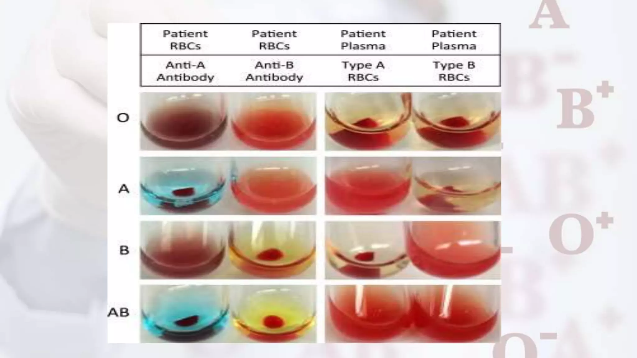 ABO blood.pptx | Blood Disorders | Diseases and Conditions