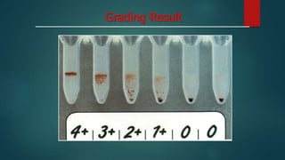 Abo blood grouping | PPTX