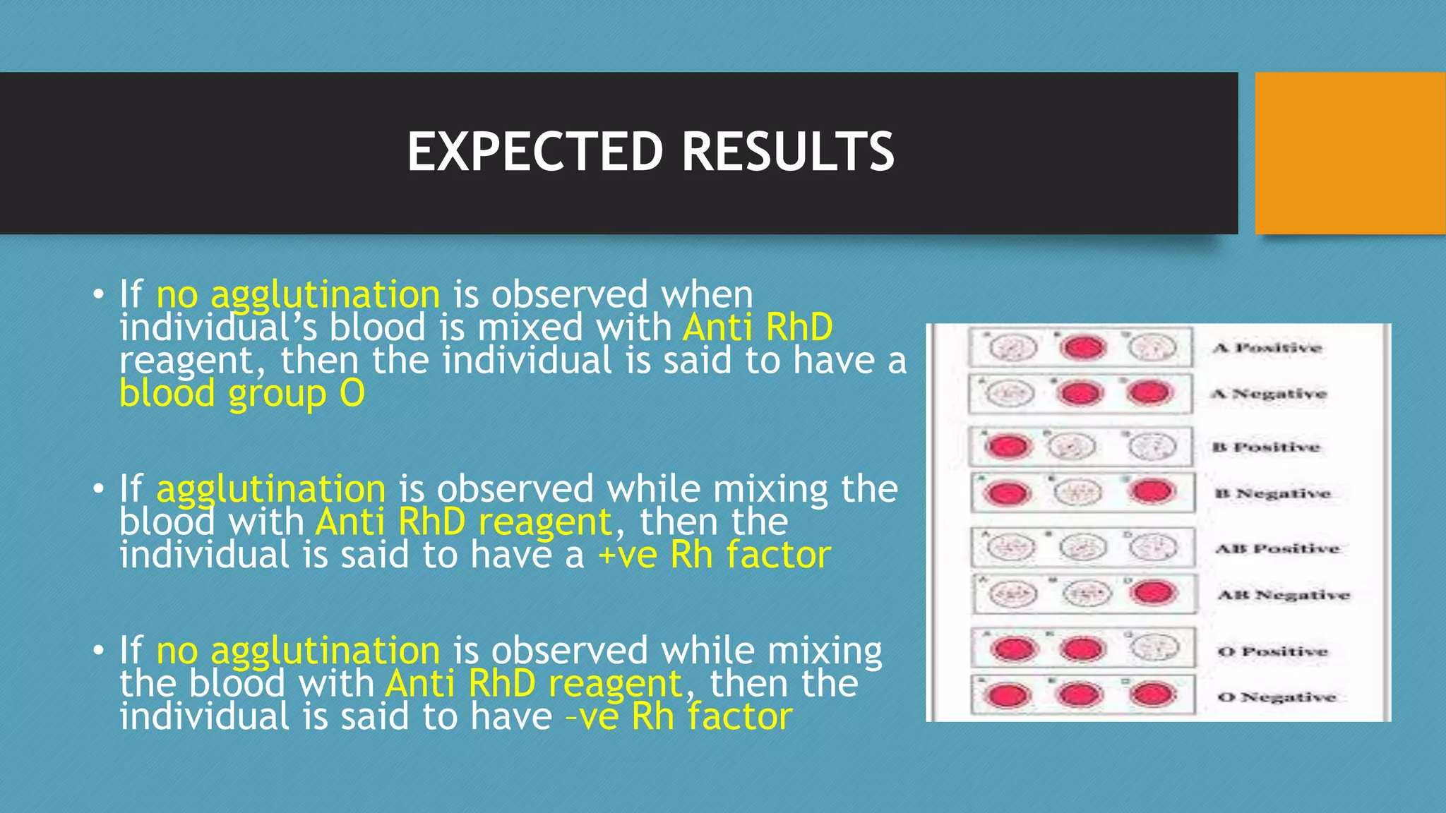 ABO Blood Grouping | PPTX
