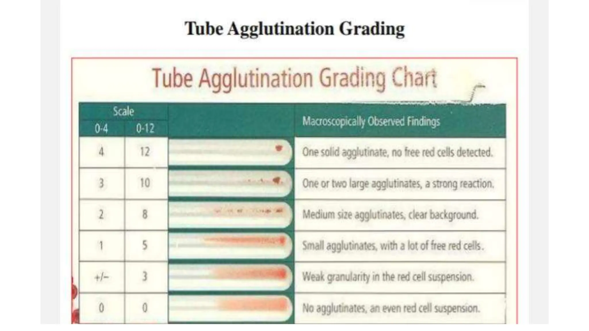 Abo DISCREPANCIES blood bank abo system.pptx