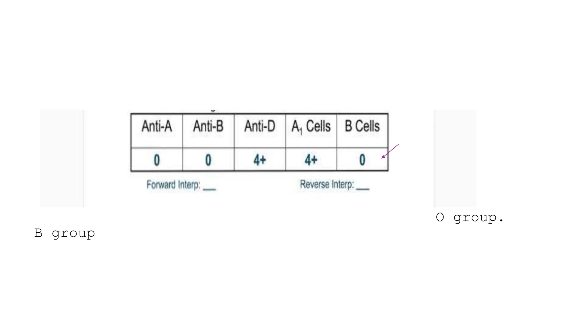 Abo DISCREPANCIES blood bank abo system.pptx