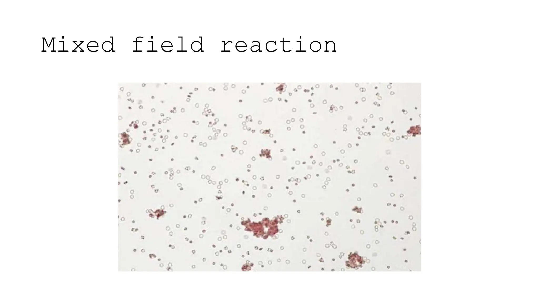 Abo DISCREPANCIES blood bank abo system.pptx