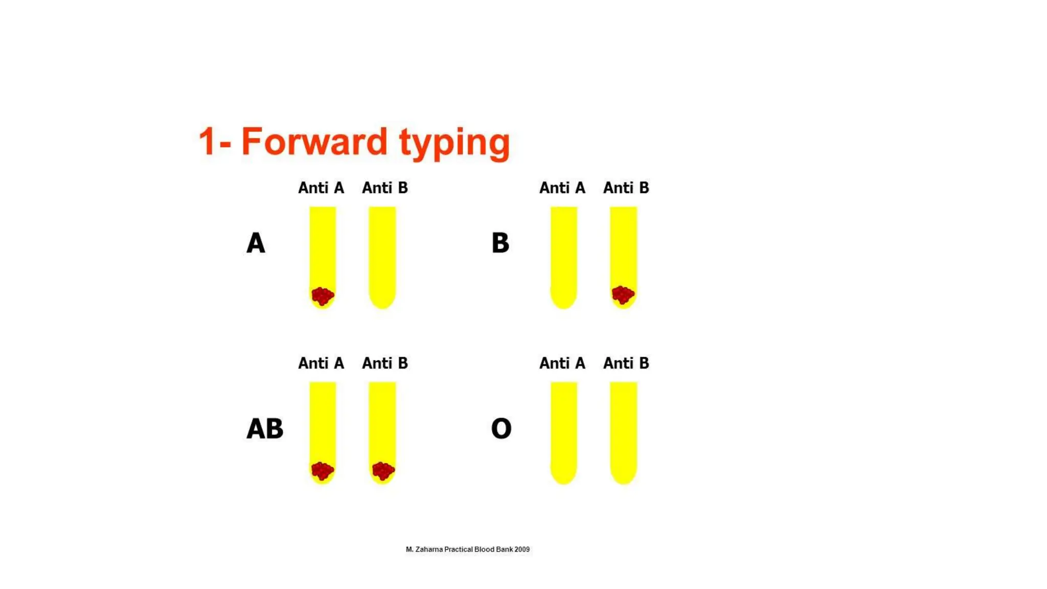 Abo DISCREPANCIES blood bank abo system.pptx