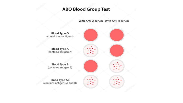 Abo DISCREPANCIES blood bank abo system.pptx