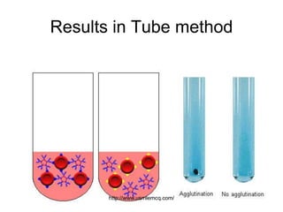 Abo Blood groups | PPTX