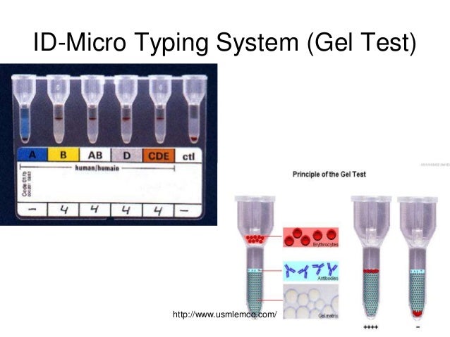 Abo Blood groups