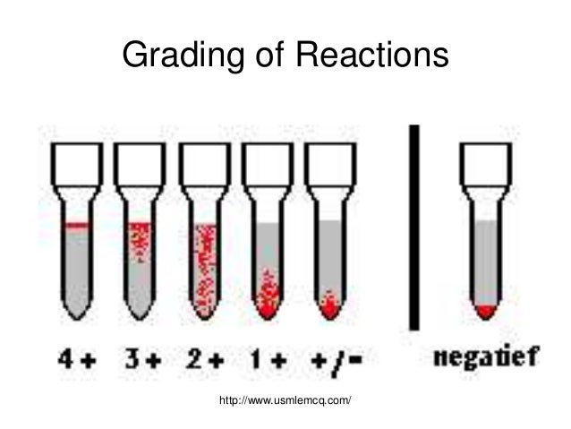 Abo Blood groups