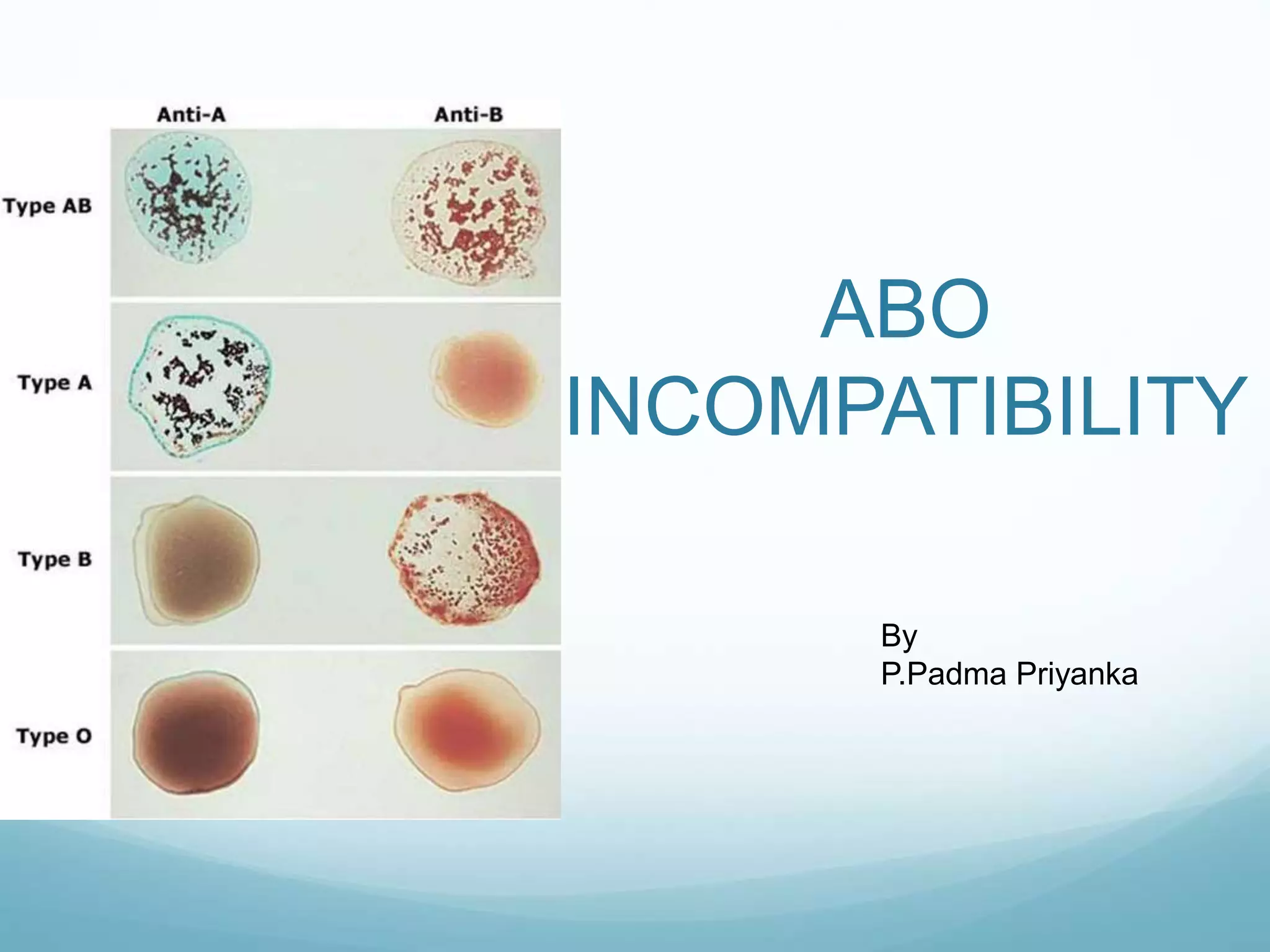 ABO incompatibility | PPTX