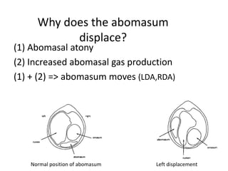 Abomasal_displacement.pptx. BOTH LD & RD | PPTX