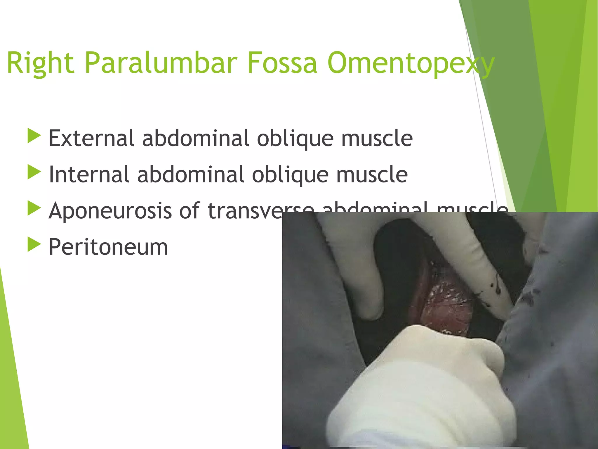 Abomasal displacements and volvulus | PPT
