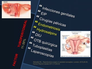 Abordaje de infertilidad.cnicreaclaseinfertilidad.ppt