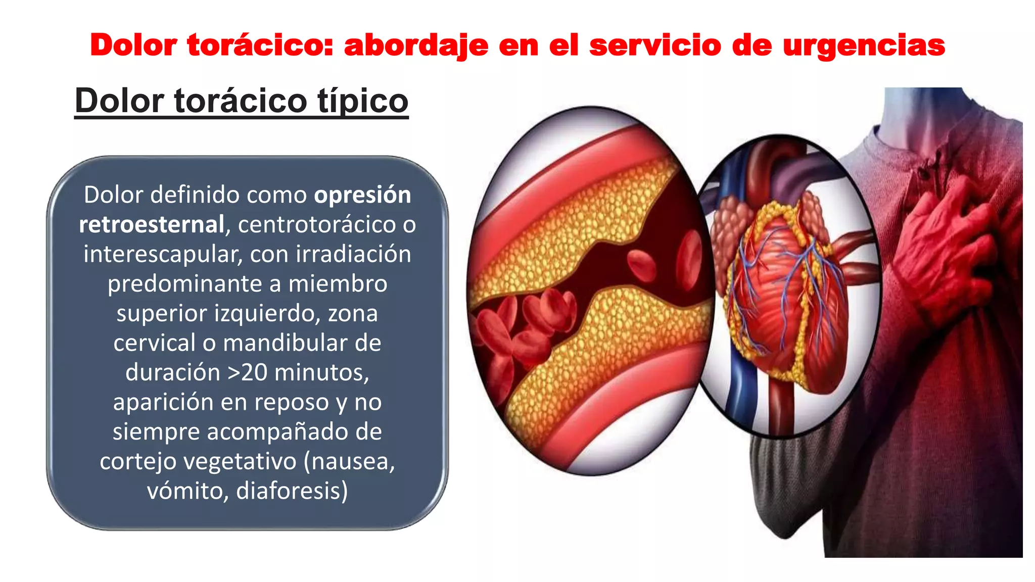 abordaje del dolor toracico.pptx