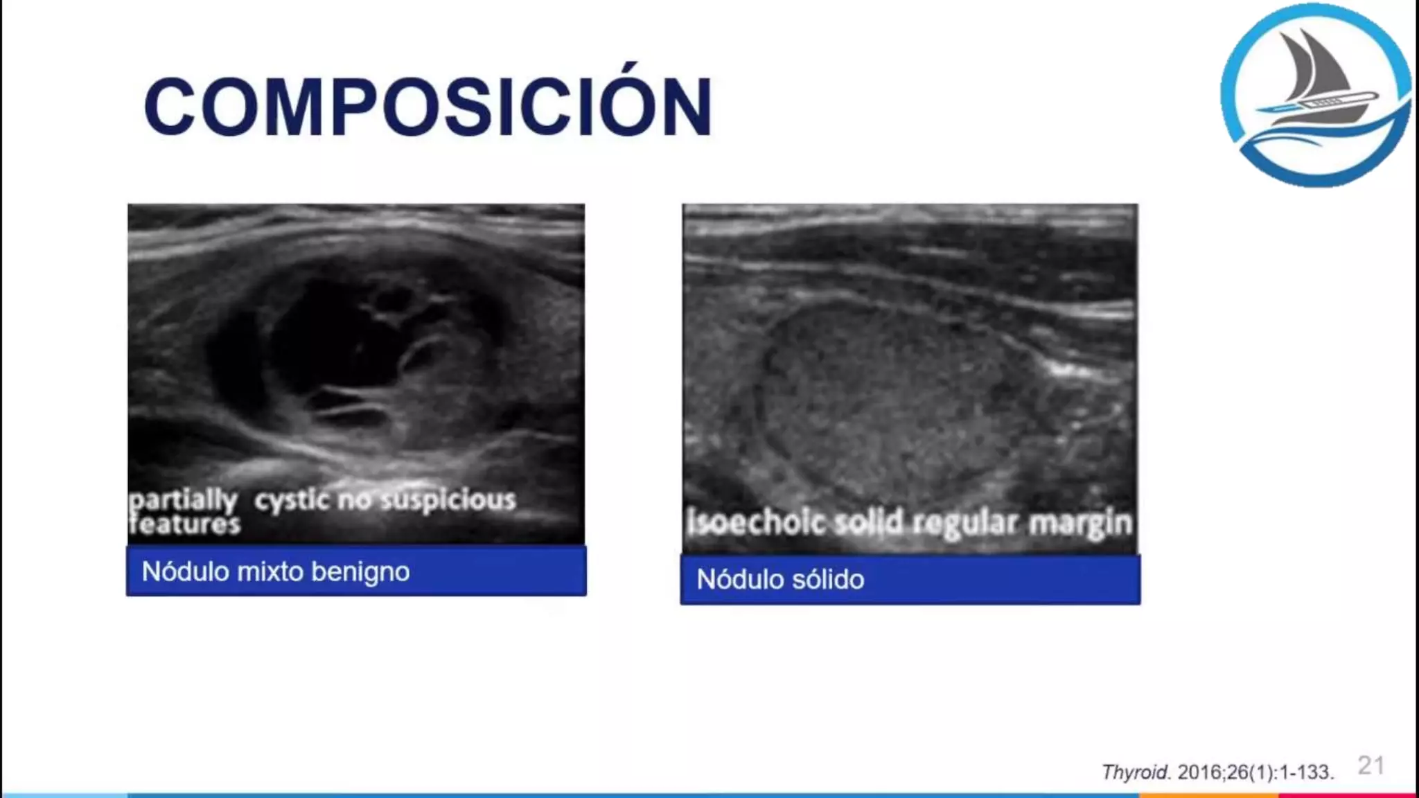 ABORDAJE DEL NÓDULO TIROIDEO Y CANCER DE TIROIDES.pptx