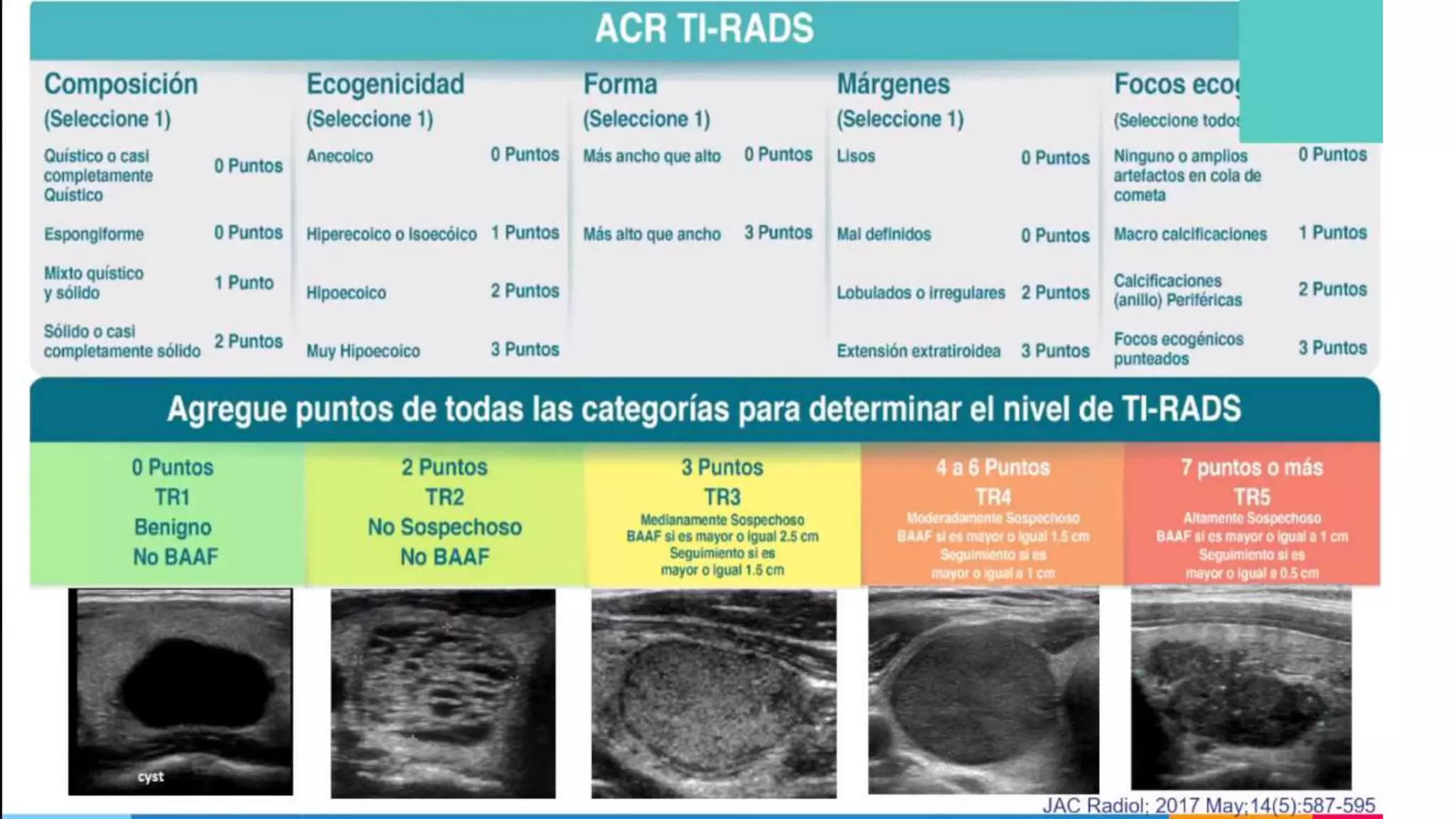 ABORDAJE DEL NÓDULO TIROIDEO Y CANCER DE TIROIDES.pptx