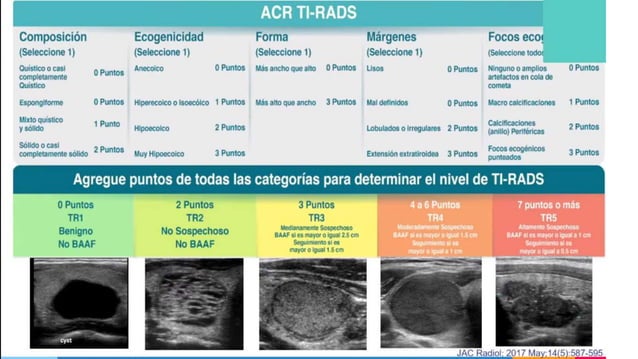ABORDAJE DEL NÓDULO TIROIDEO Y CANCER DE TIROIDES.pptx