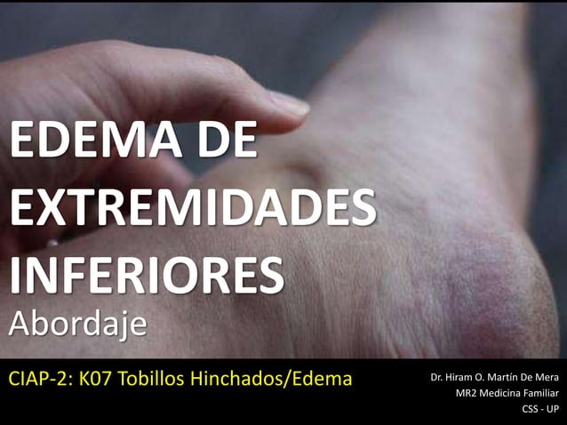 Abordaje del paciente con edema de extremidades inferiores | PPTX ...