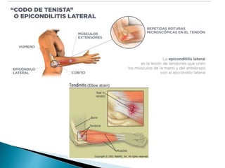 Abordaje del paciente reumatico | PPTX