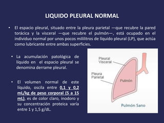 Abordaje diagnostico del derrame pleural expo | PPTX