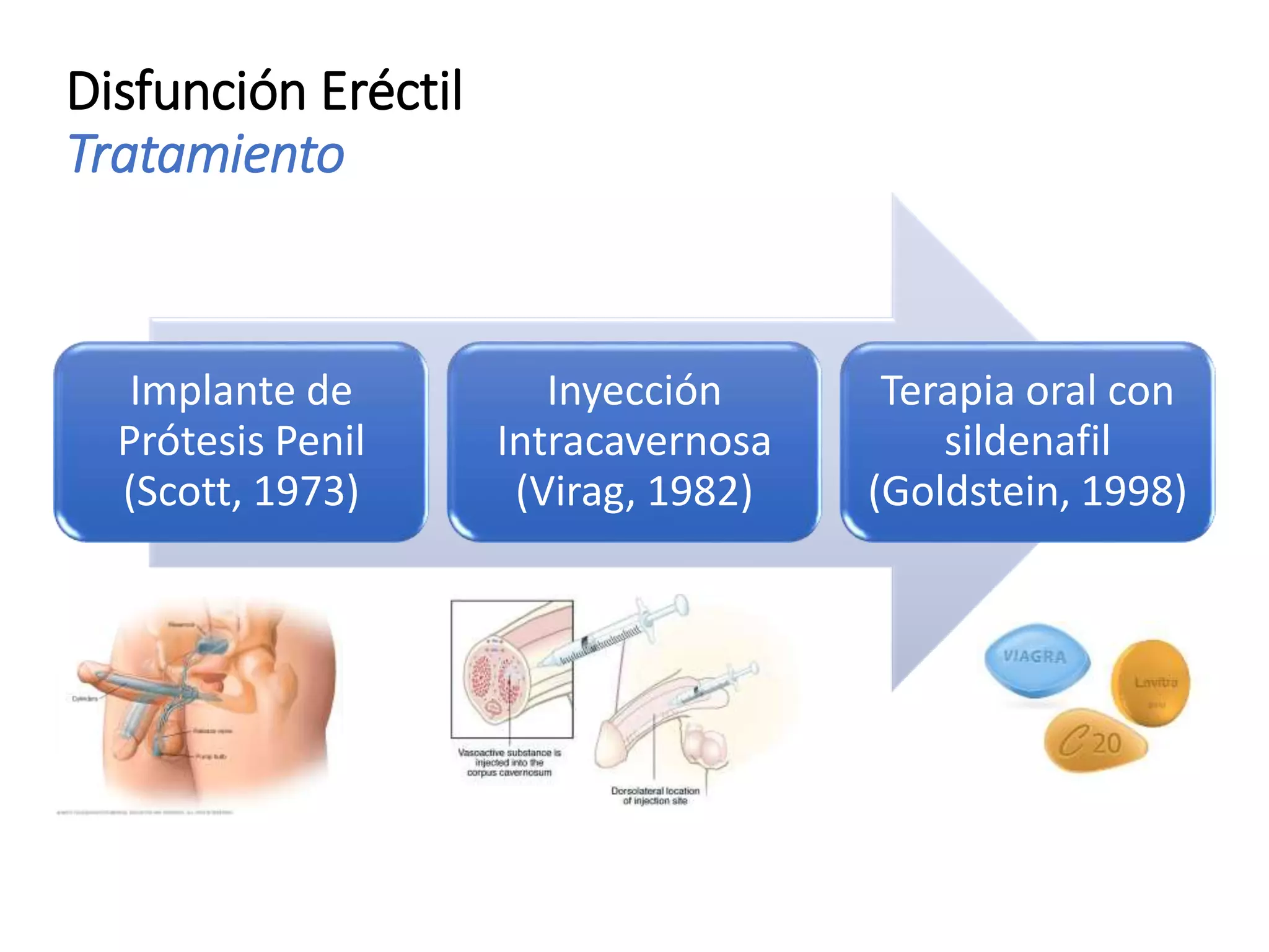 Disfuncion Erectil | PPTX
