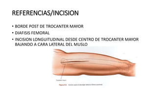 ABORDAJE DE LA FRACTURA DE FEMUR DIAGNOSTICO Y TRATAMIENTO | PPTX