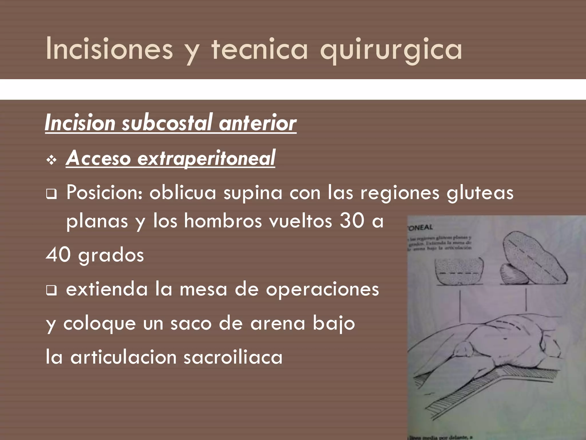 Abordaje quirurgico retroperitoneal | PPTX
