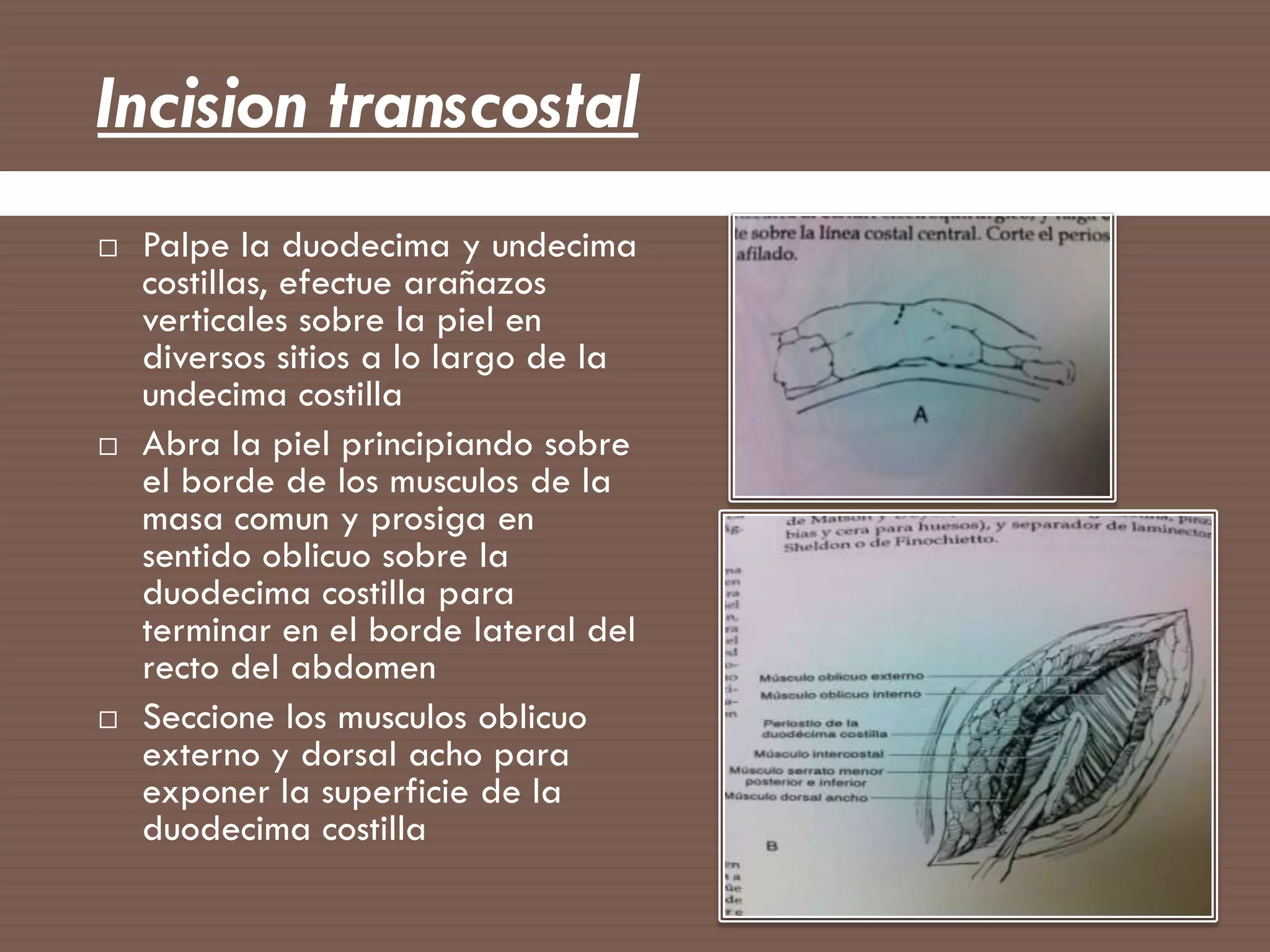 Abordaje quirurgico retroperitoneal | PPTX