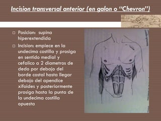 Abordaje quirurgico retroperitoneal | PPTX