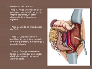 Abordaje quirurgico retroperitoneal | PPTX
