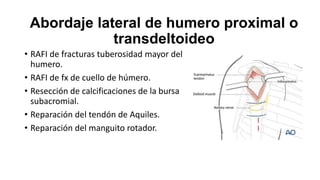 PRINCIPALES ABORDAJES DE HUMERO PROXIMAL.pptx