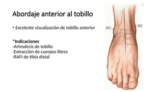 Abordajes de tarso y tobillo en traumatologia y ortopedia .pptx