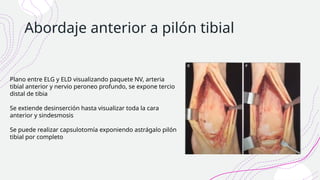 Abordajes quirúrgicos a tibia y peroné.pptx