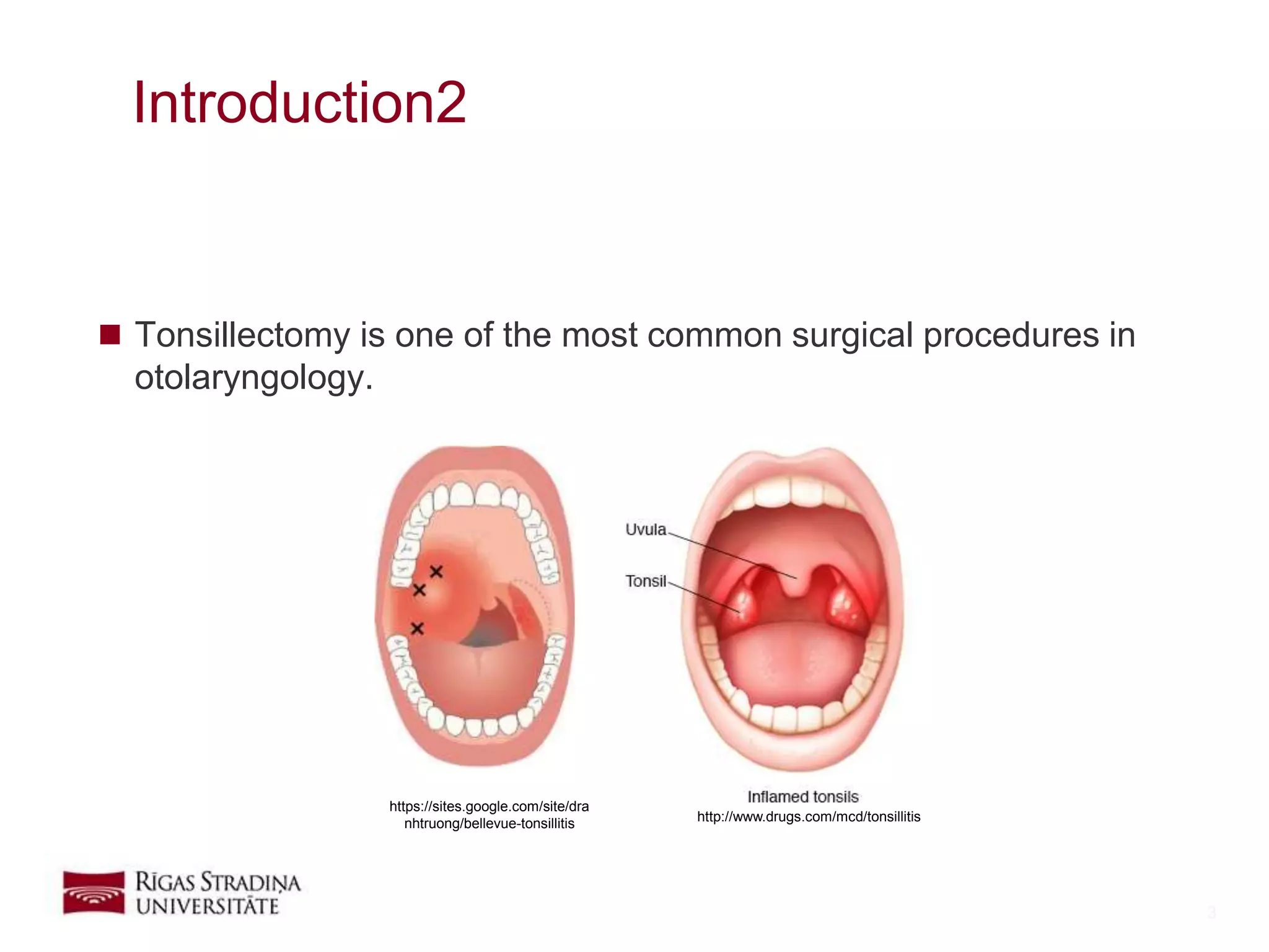 TASTE DISORDERS AFTER TONSILLECTOMY | PPT