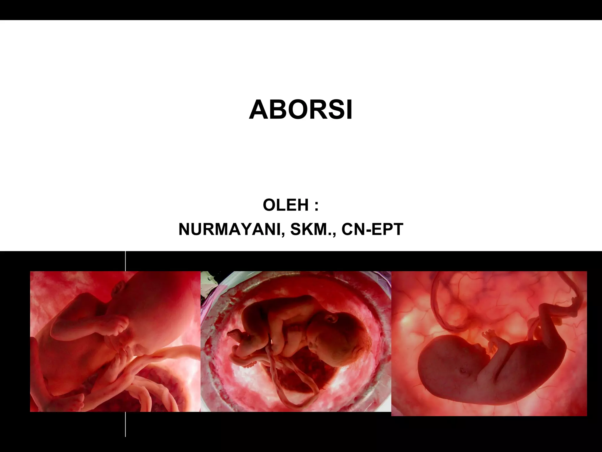 aborsi (kesadaran wanita) | PPT