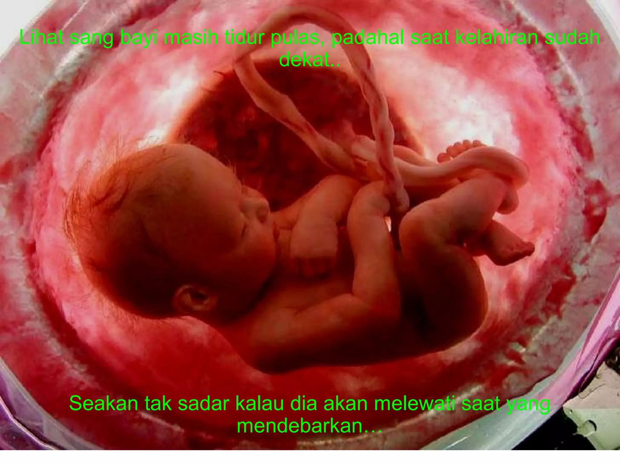 aborsi (kesadaran wanita) | PPT