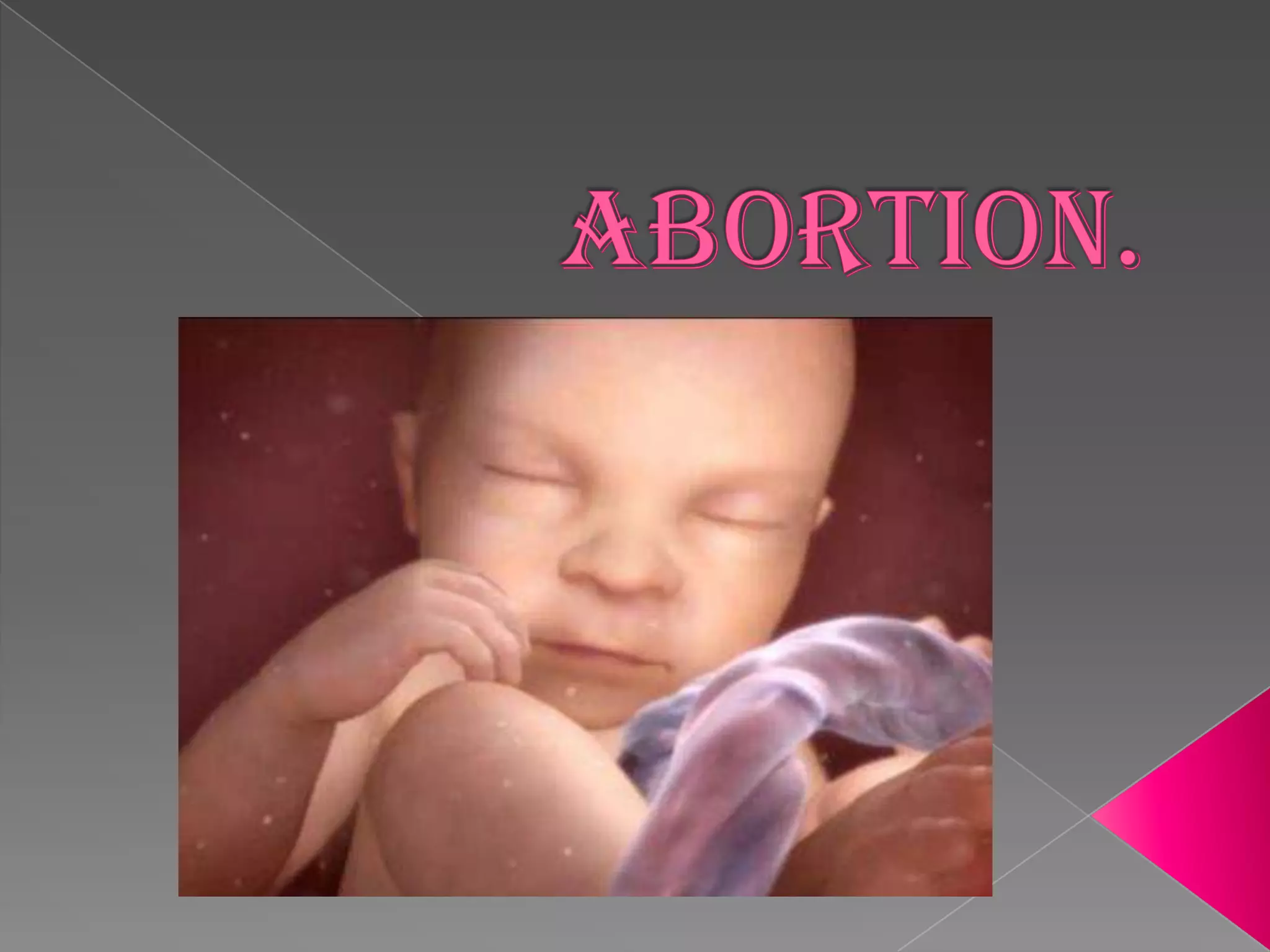 Abortion | PPTX