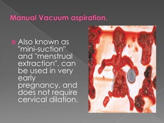 Abortion | PPTX